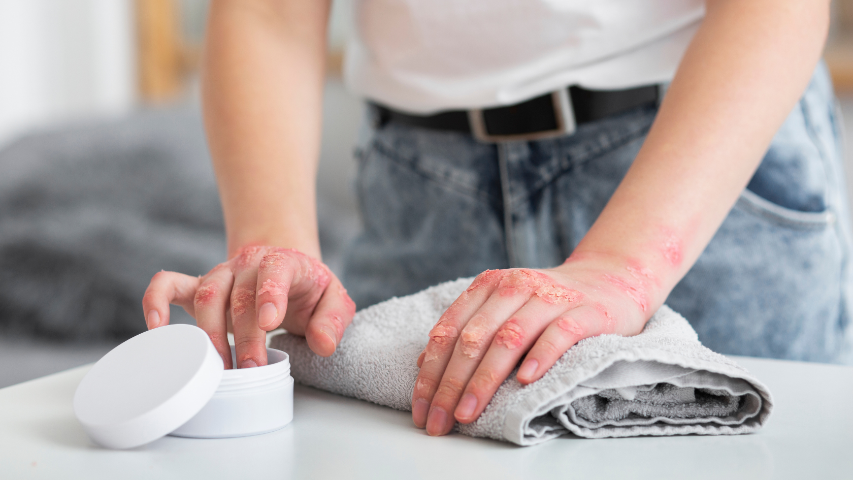 What is a Vesicant? - Orion Health & Wellness Services